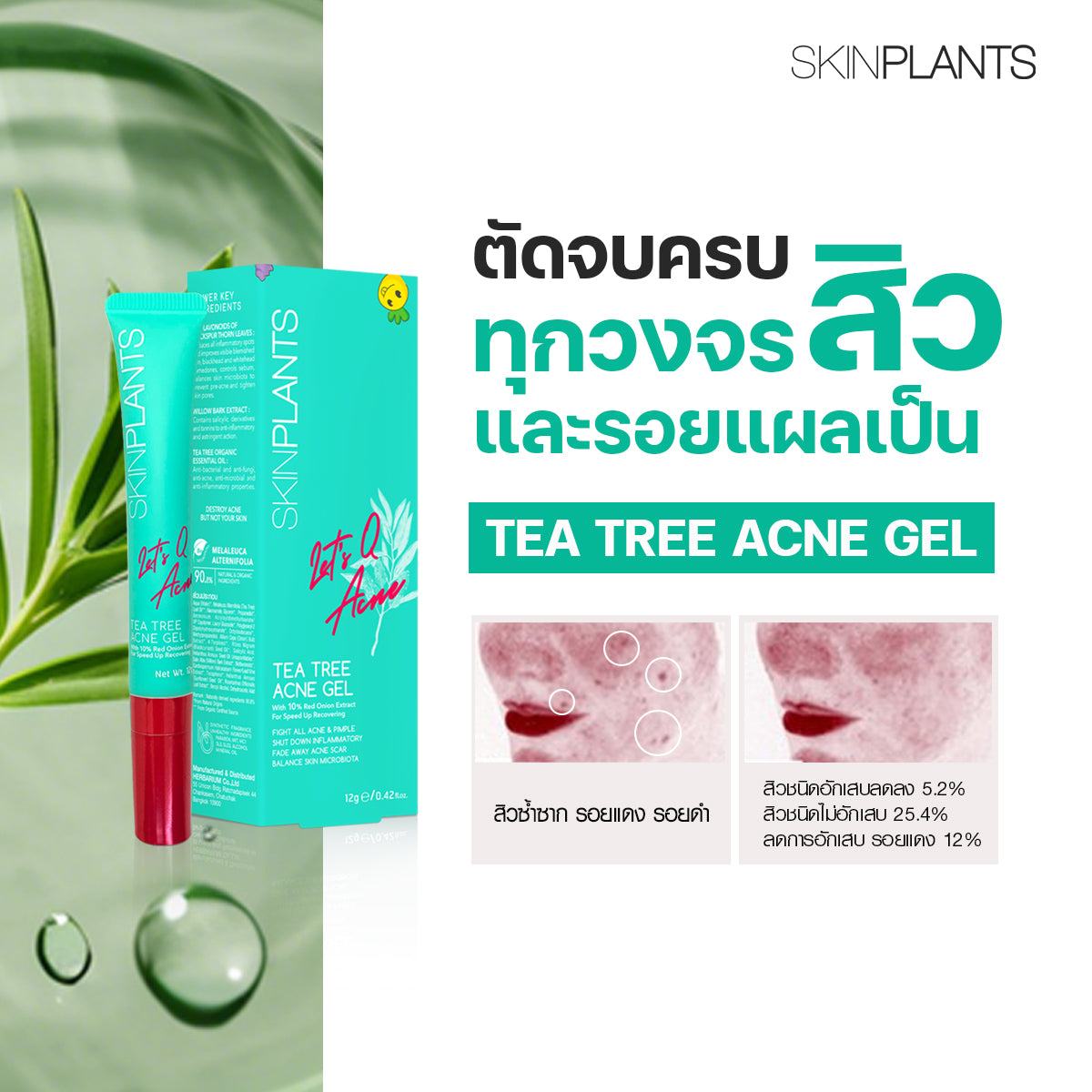 Tea Tree Acne Gel – Skinplants